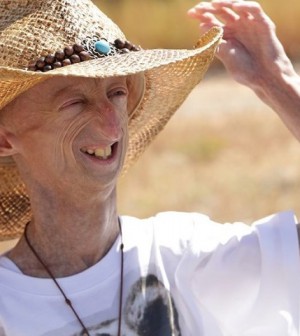 Sanremo 2015, ospite Sammy Basso: la sua storia commuove il pubblico ...