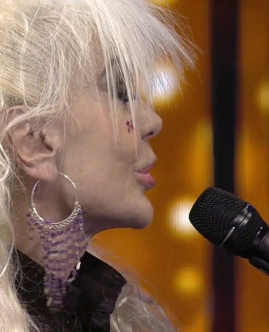 Donatella Rettore spiega a Ora o mai più come si è fatta male - LaNostraTv